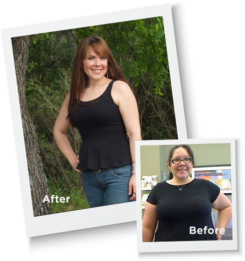 Bariatric Surgery in Austin, TX | Dr. Sashi Ganta | NuSelf Bariatrics